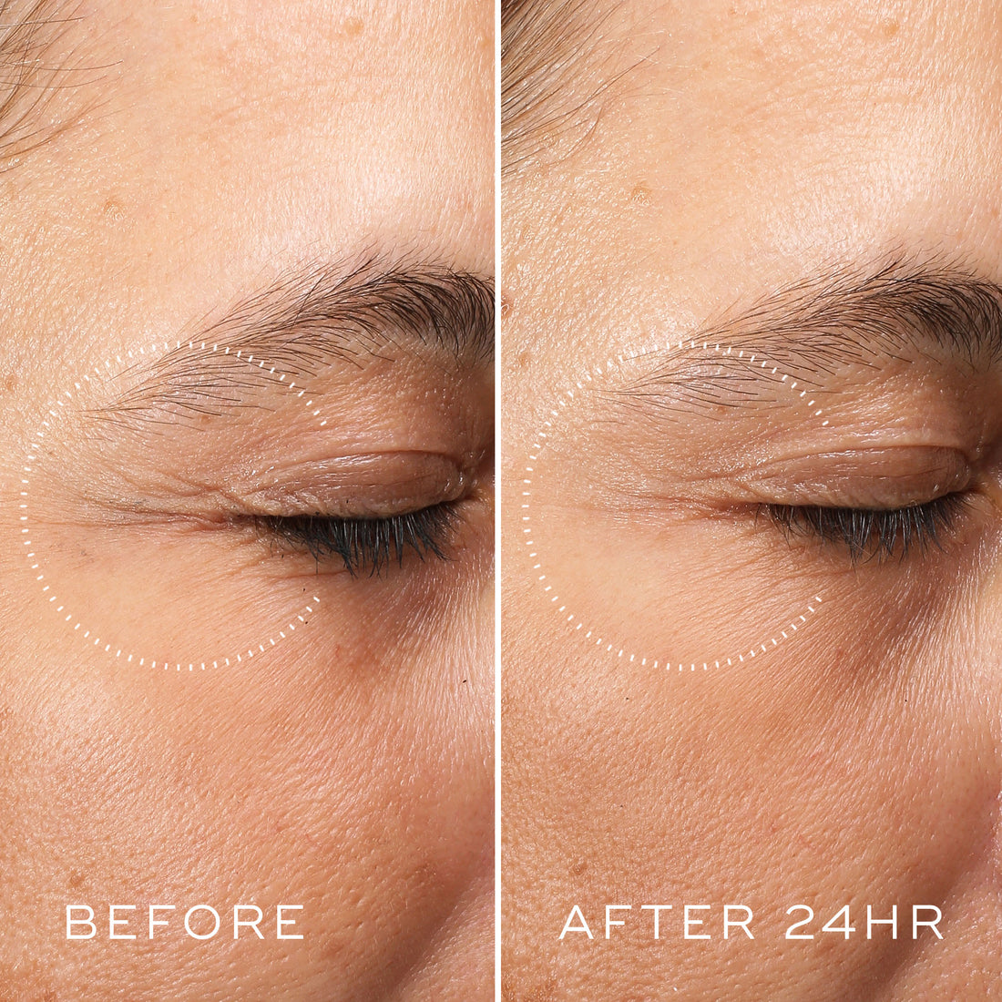 Retinaldehyde Skincare – Medik8-EU